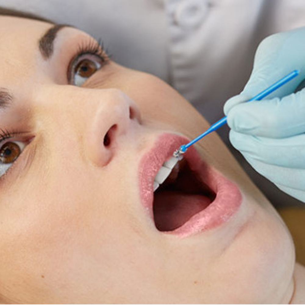 Buy Microbrush Stix Applicators Online at Best Price | Dentalaaka.com