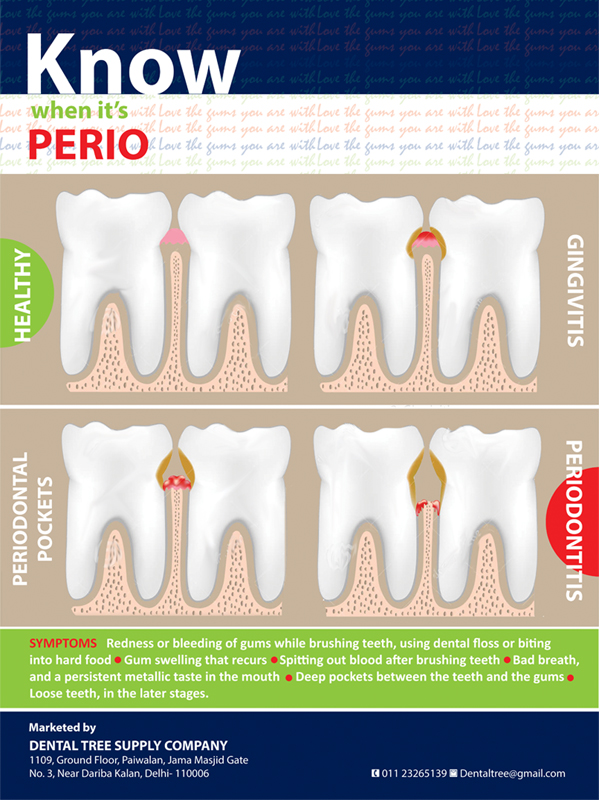 Buy Periodontology Poster Online at Best Price | Dentalaaka.com